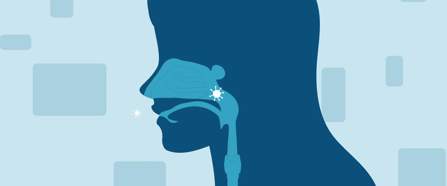Probi Defendum® probiotic mode of action - Probi