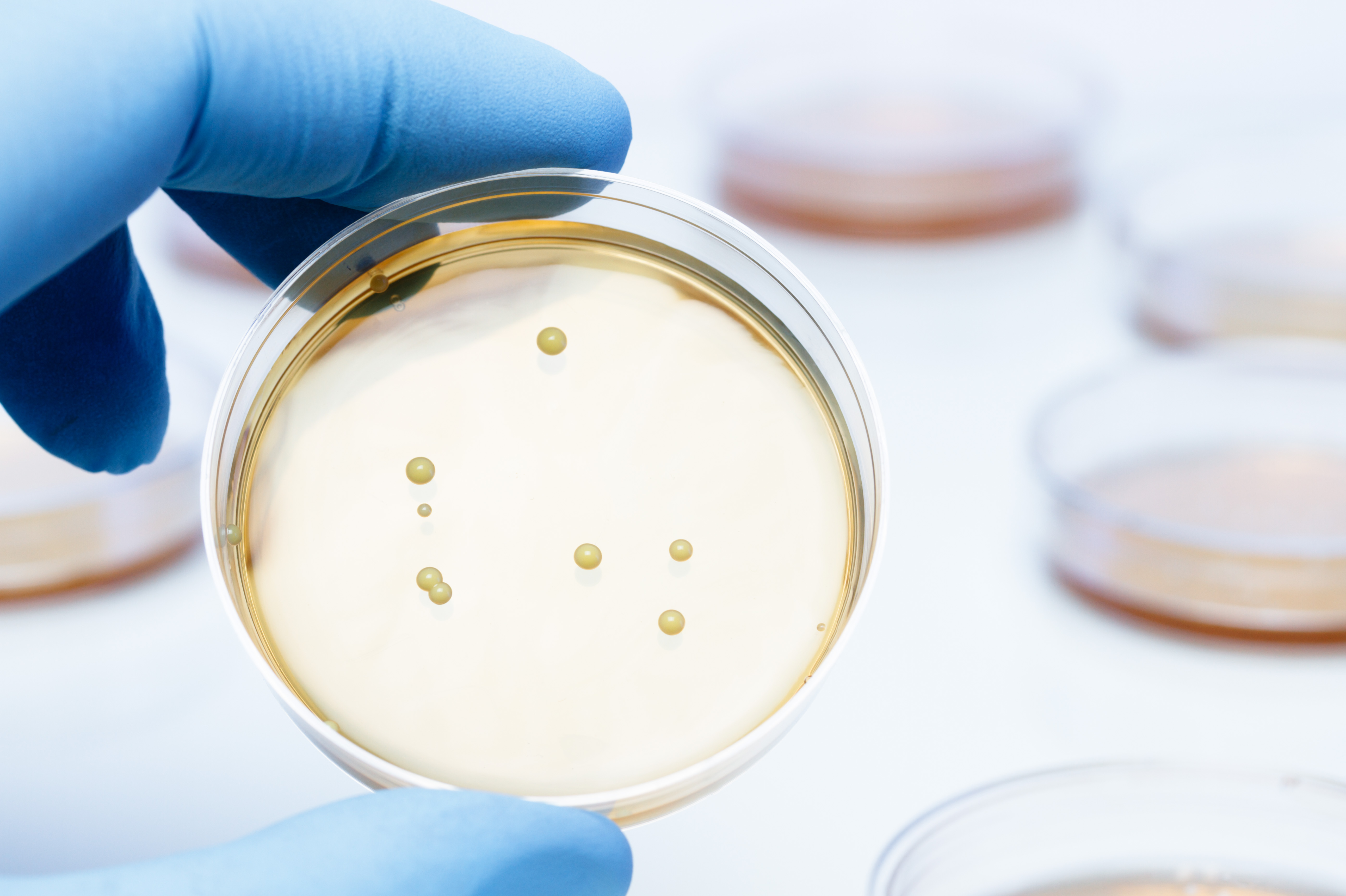 What are probiotics? - Probi